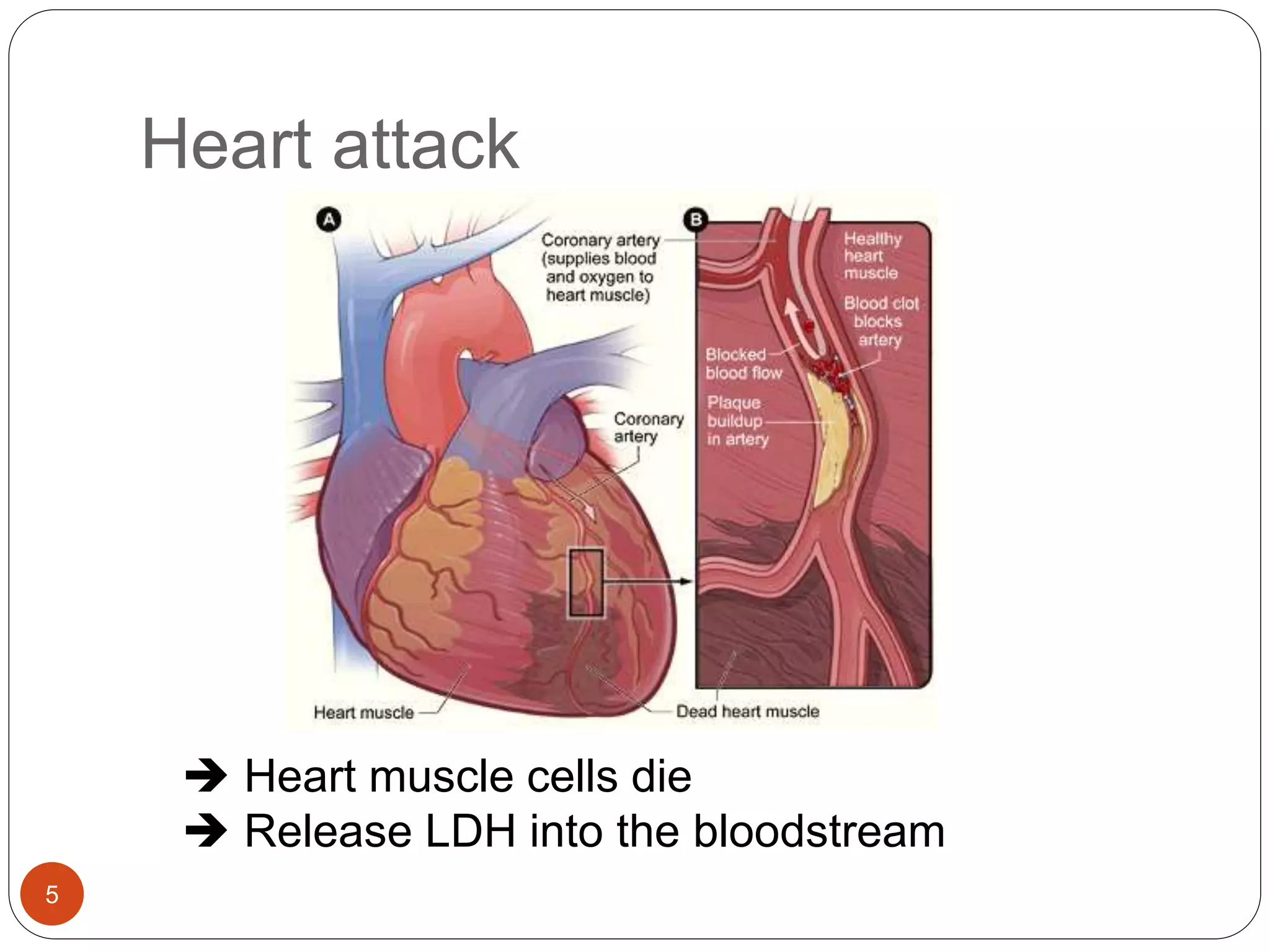 Lactate dehydrogenase assays | PPTX
