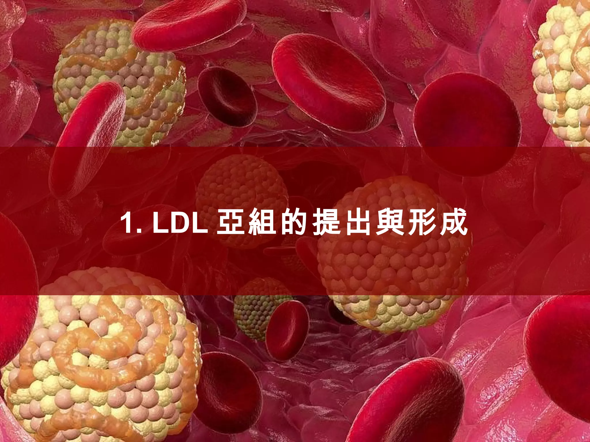 Three-Hypers Series：Hyperlipidemia – 07 Small, dense LDL - an important ...