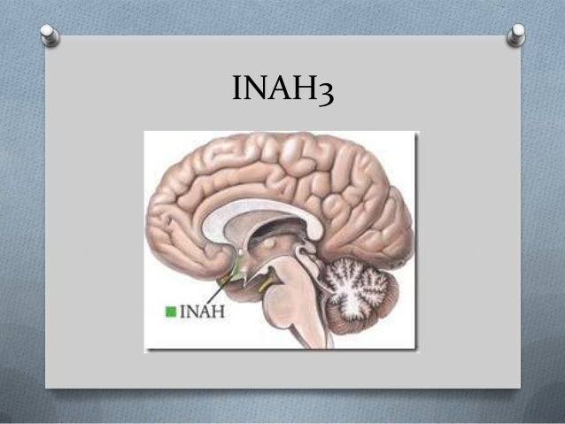 SEXUALIDAD - Mind Map