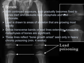 LEAD POISONING | PPTX