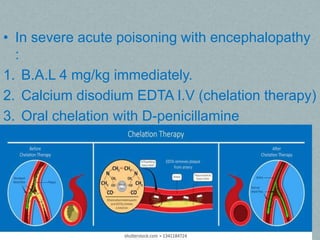 LEAD POISONING | PPTX
