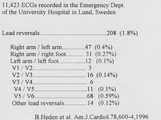 Lead errors introduction | PPT | Heart and Cardiovascular Diseases ...