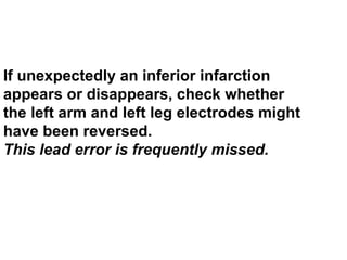 Lead errors: reversal of limb leads | PPT