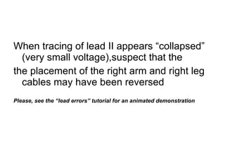 Lead errors: reversal of limb leads | PPT