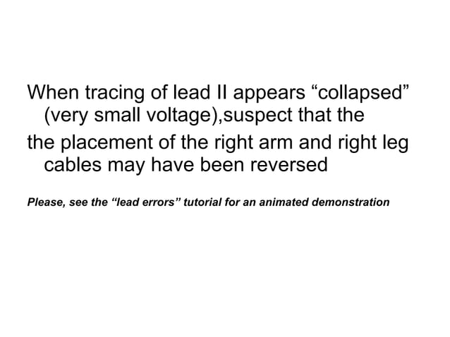 Lead errors: reversal of limb leads | PPT