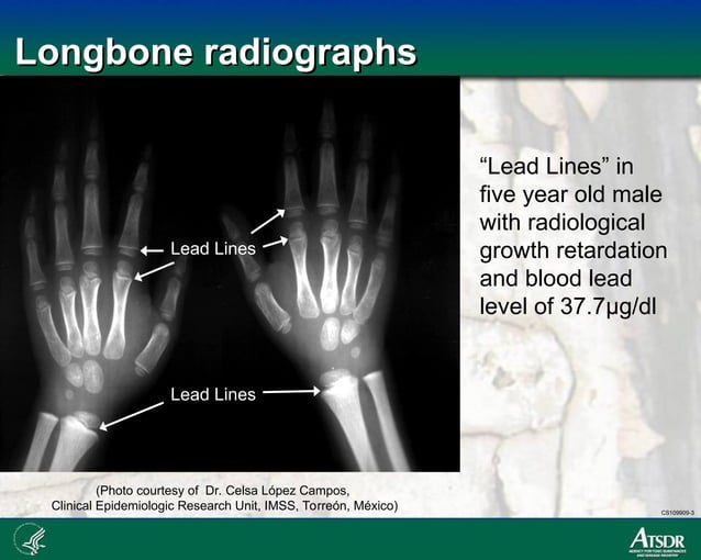 lead_grand_rounds.ppt FOR DEUWHWHDFFFYDFF QQF | PPT