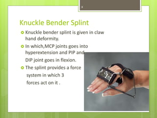 Leading the world towrads robotic function in hand restoration | PPTX