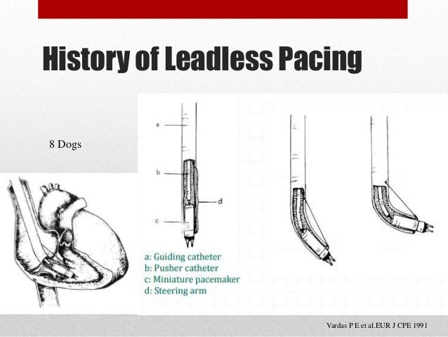Leadless pacemaker