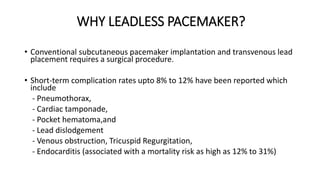 Leadless pacemaker | PPT