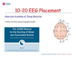 IDEAL Lead Placement IN EEG-10-20 SYSTEM.pdf