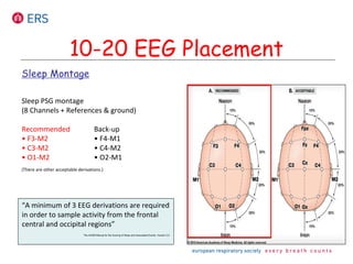IDEAL Lead Placement IN EEG-10-20 SYSTEM.pdf