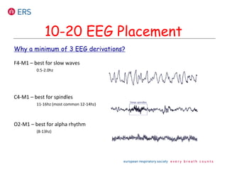 IDEAL Lead Placement IN EEG-10-20 SYSTEM.pdf