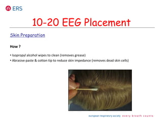 IDEAL Lead Placement IN EEG-10-20 SYSTEM.pdf