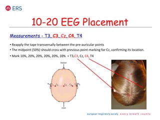 IDEAL Lead Placement IN EEG-10-20 SYSTEM.pdf