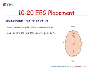 IDEAL Lead Placement IN EEG-10-20 SYSTEM.pdf