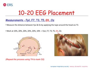 IDEAL Lead Placement IN EEG-10-20 SYSTEM.pdf