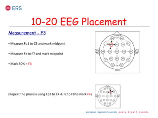 IDEAL Lead Placement IN EEG-10-20 SYSTEM.pdf