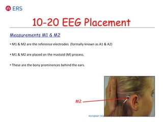 IDEAL Lead Placement IN EEG-10-20 SYSTEM.pdf