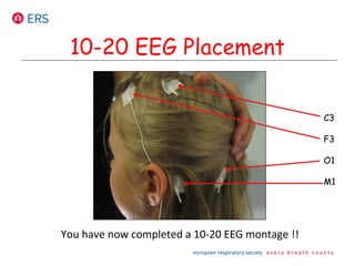 IDEAL Lead Placement IN EEG-10-20 SYSTEM.pdf