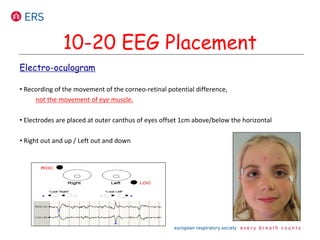 IDEAL Lead Placement IN EEG-10-20 SYSTEM.pdf