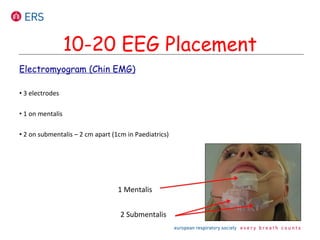 IDEAL Lead Placement IN EEG-10-20 SYSTEM.pdf