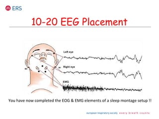 IDEAL Lead Placement IN EEG-10-20 SYSTEM.pdf