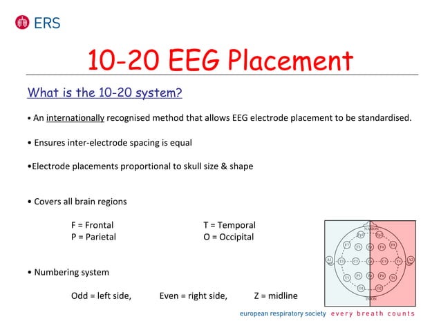 IDEAL Lead Placement IN EEG-10-20 SYSTEM.pdf