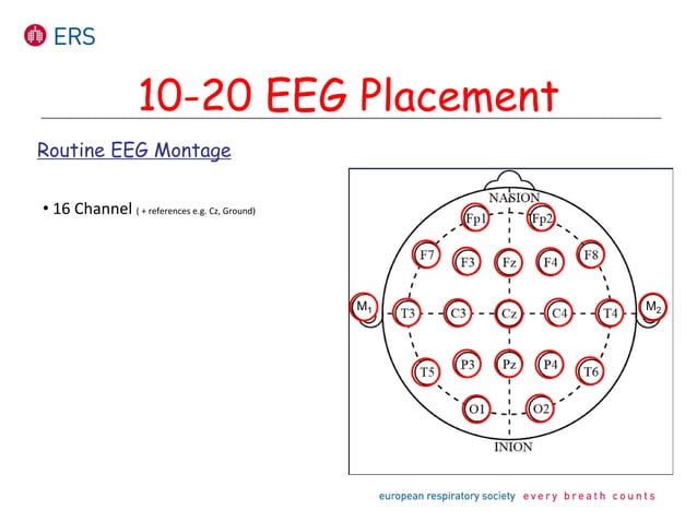 IDEAL Lead Placement IN EEG-10-20 SYSTEM.pdf