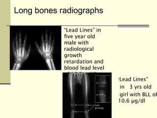 Lead poisoning in Pediatrics | PPT