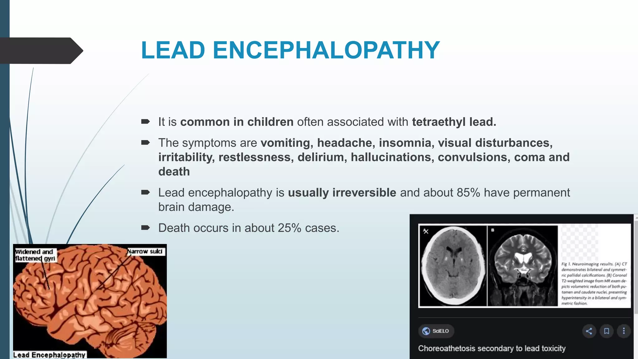 leadpoisoning-191203075145 (2).pdf