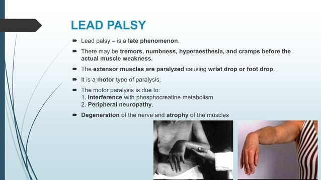 leadpoisoning-191203075145 (2).pdf