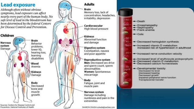 Lead poisoning in neurology