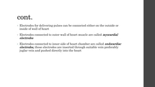 Pacemaker lead wires and electrodes by Haleeful Jud | PPT | Free Download