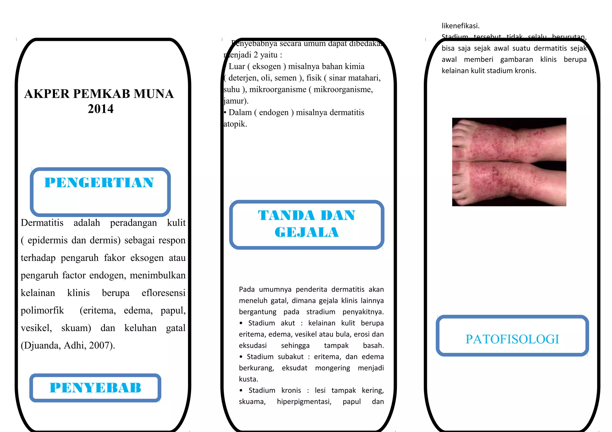 Leaflet dermatitis akper muna | DOC