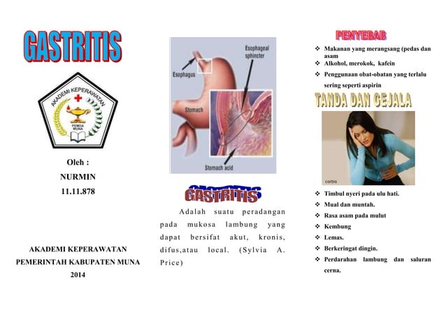 Leaflet gastritis akper pemkab muna | DOCX