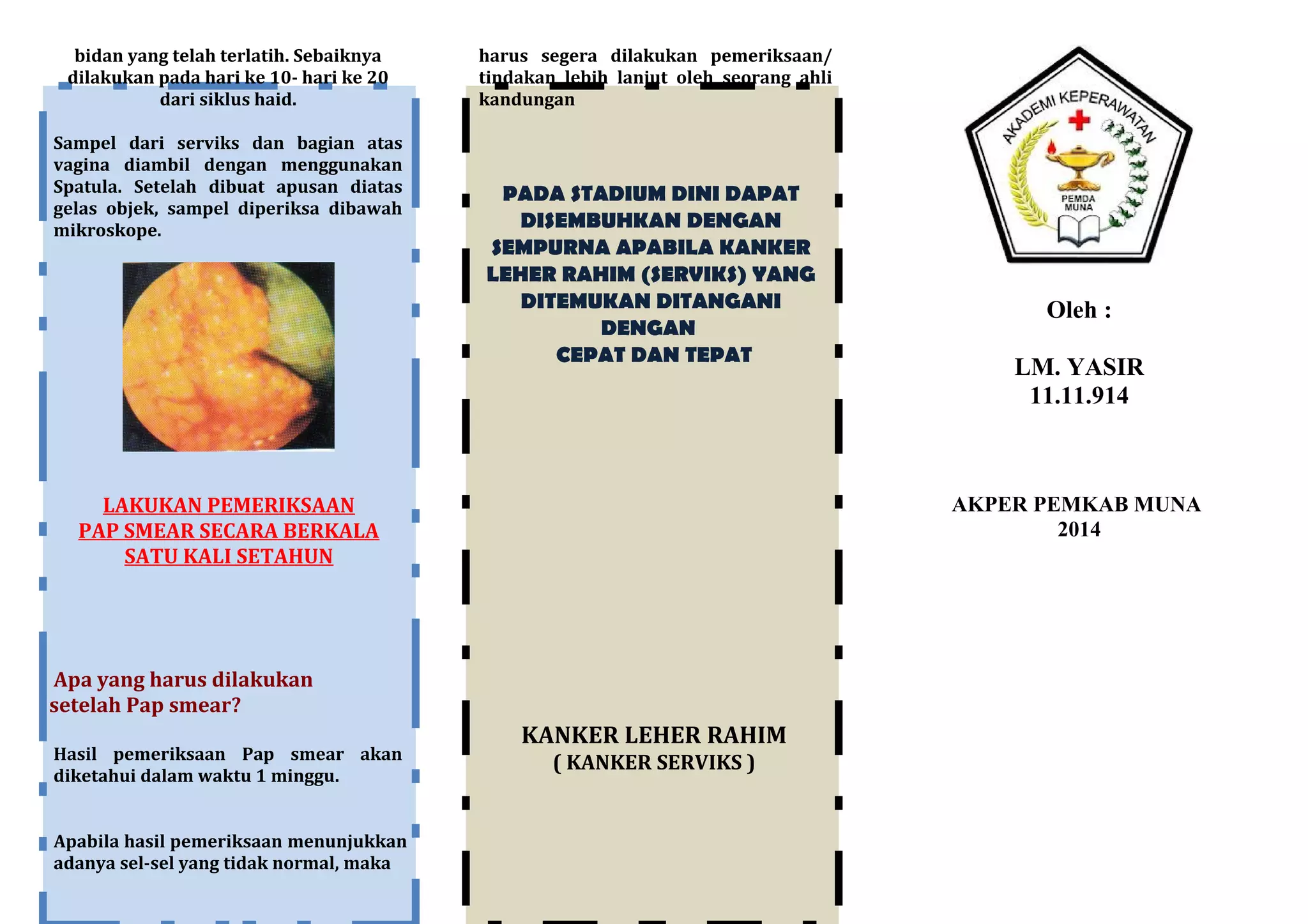 Leaflet kanker serviks | PPT