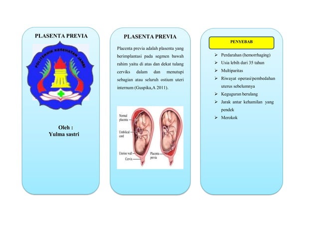 leaflet plasenta previa untuk presentasi | PDF