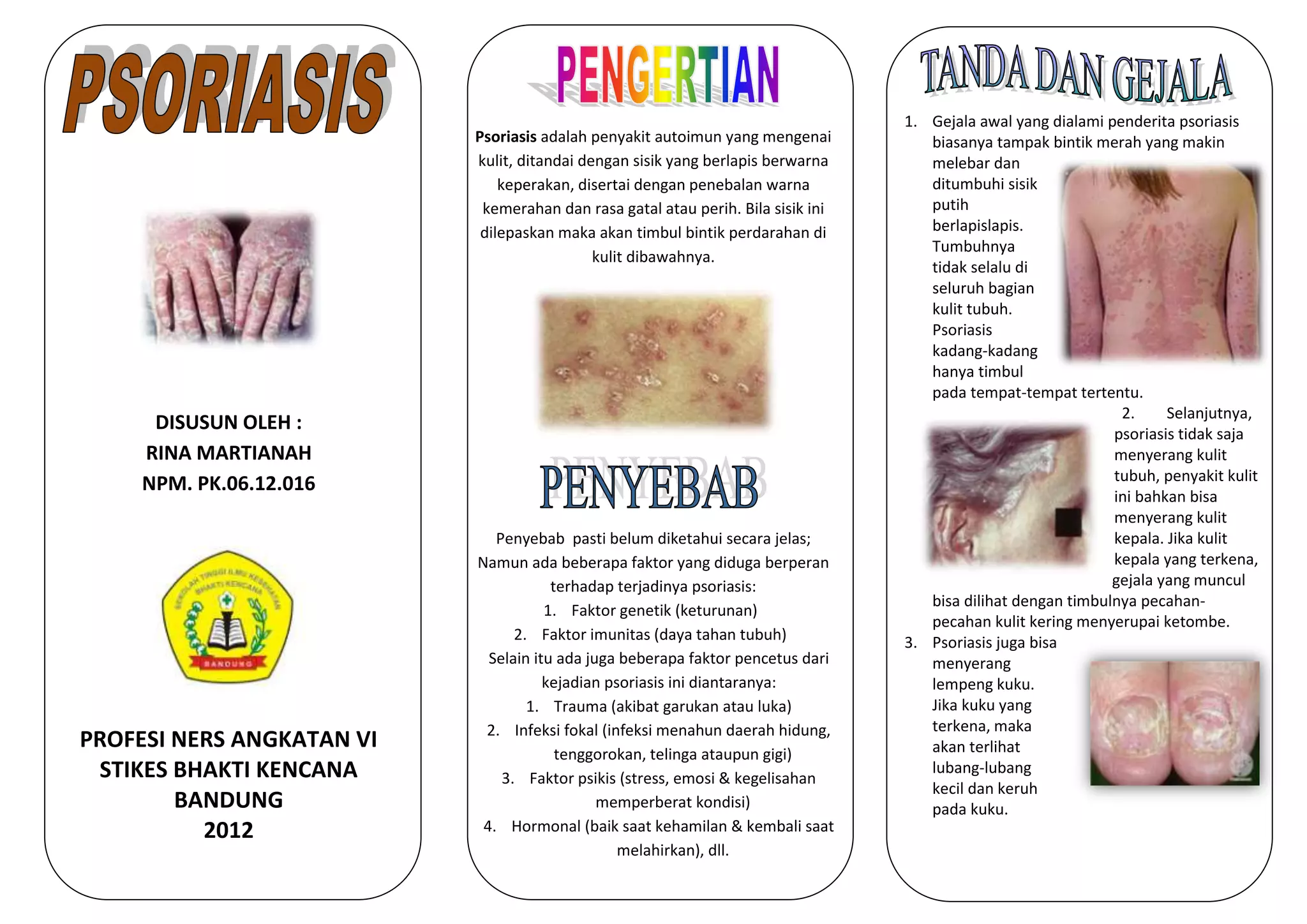 Leaflet psoriasis | DOCX