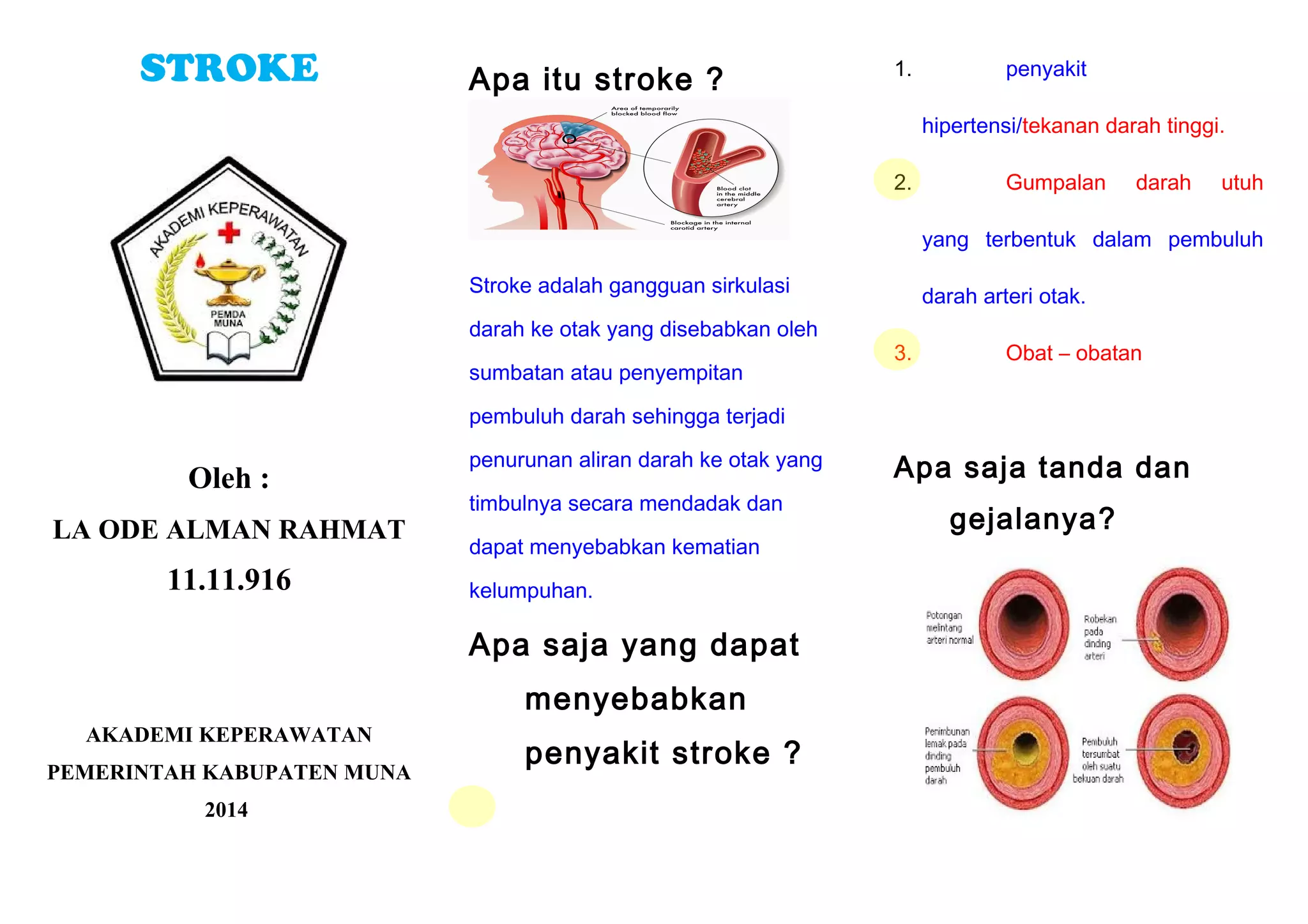 Leaflet stroke | PPT