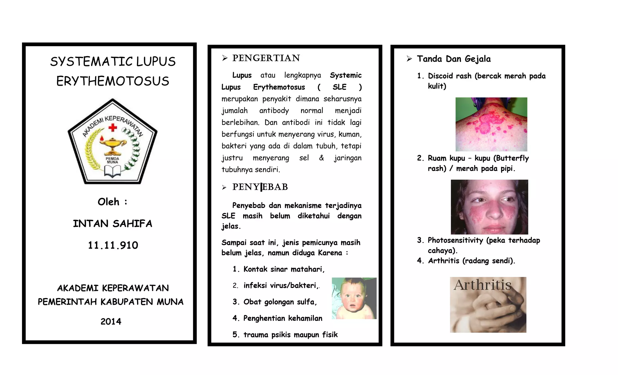 Leaflet systematic lupus erythemotosus akper pemkab muna | DOC