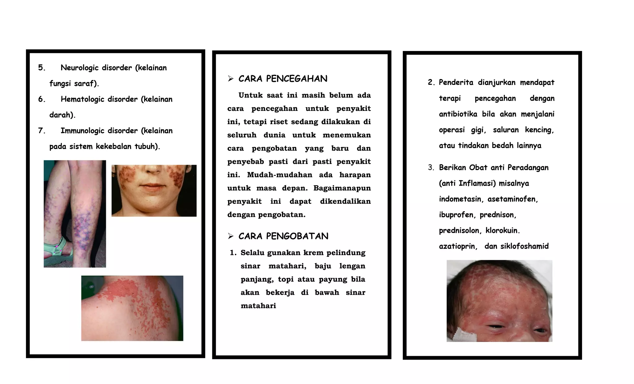 Leaflet systematic lupus erythemotosus akper pemkab muna | DOC