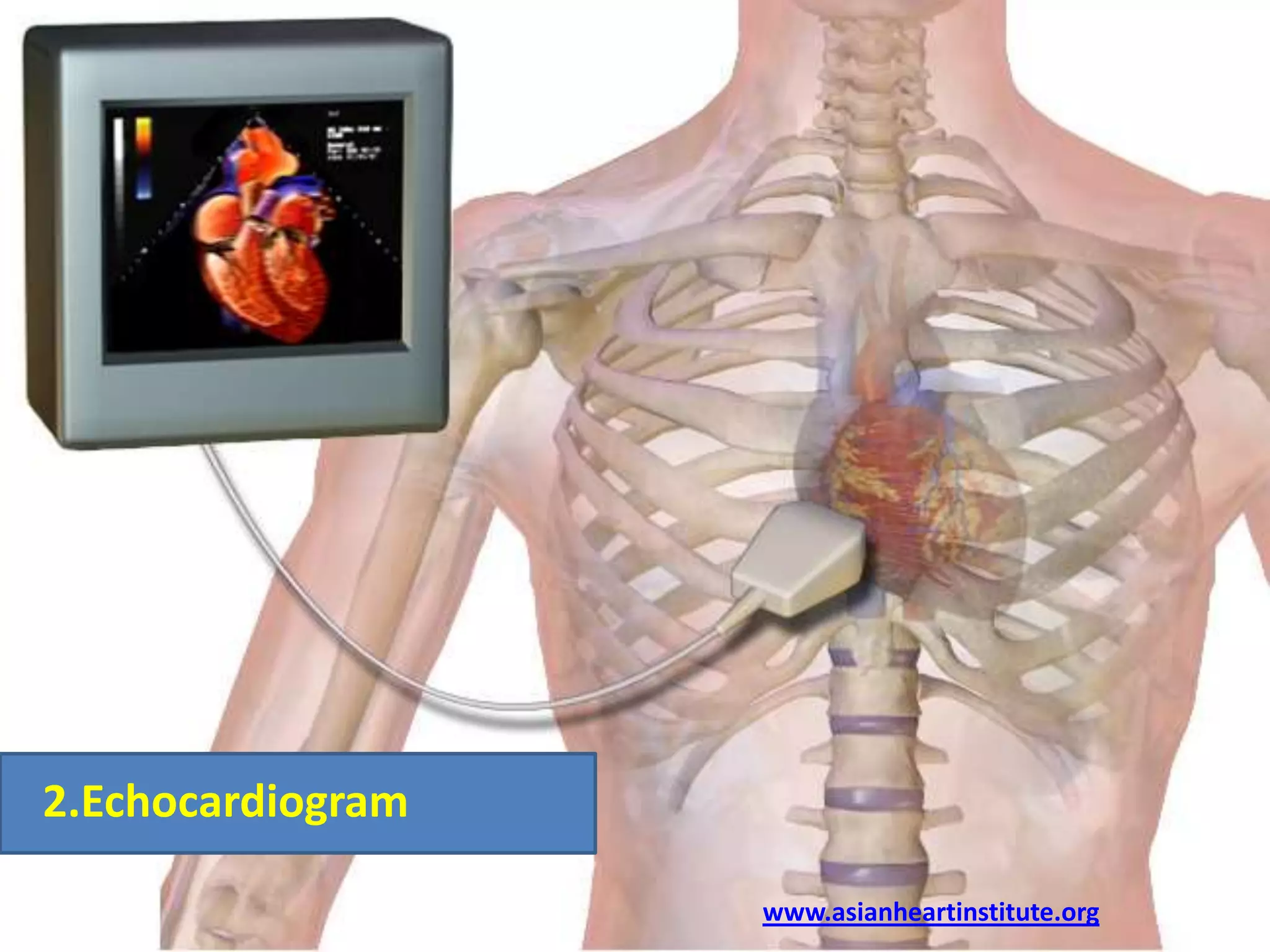 Asian Heart Institute - Leaky heart valve symptoms | PPTX