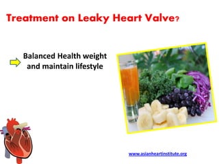 Asian Heart Institute - Leaky heart valve symptoms | PPTX