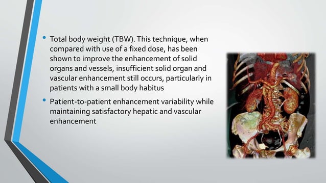 Lean body weight in contrast media CT Scan | PPT