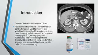 Lean body weight in contrast media CT Scan | PPTX
