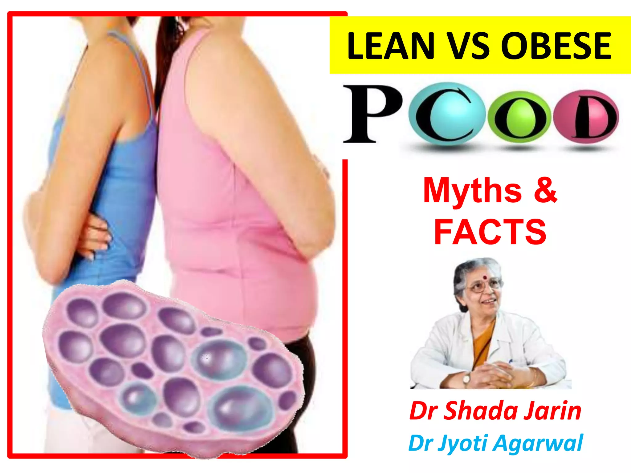 LEAN VS OBESE PCOS Myths & Facts Dr Sharda Jain & Dr Jyoti Agarwal | PPTX