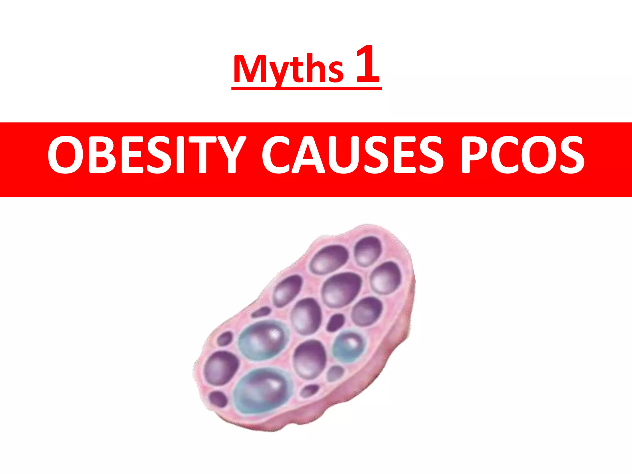 LEAN VS OBESE PCOS Myths & Facts Dr Sharda Jain & Dr Jyoti Agarwal | PPTX