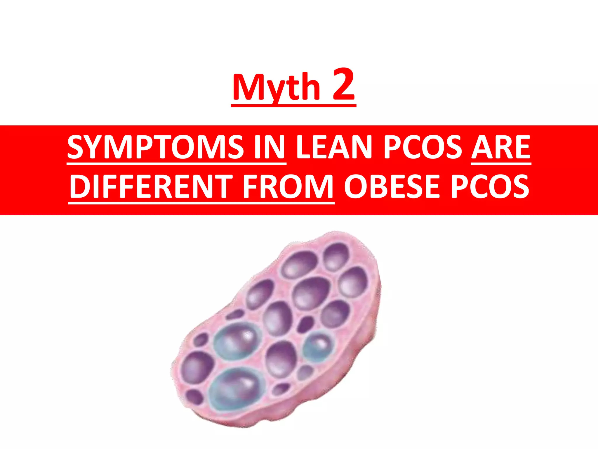 LEAN VS OBESE PCOS Myths & Facts Dr Sharda Jain & Dr Jyoti Agarwal | PPTX