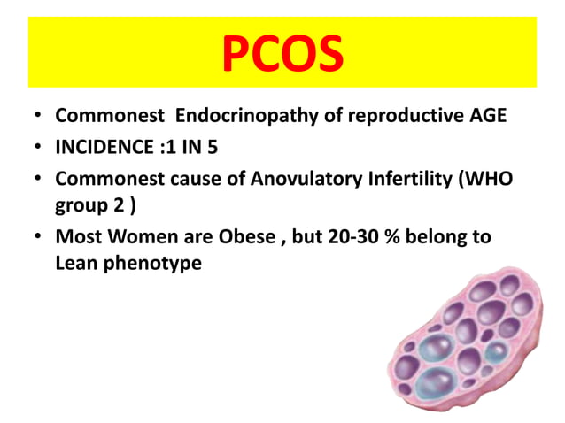 LEAN VS OBESE PCOS Myths & Facts Dr Sharda Jain & Dr Jyoti Agarwal ...