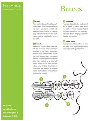 Learn More About Getting Braces At Ju School Of Orthodontics | PDF ...